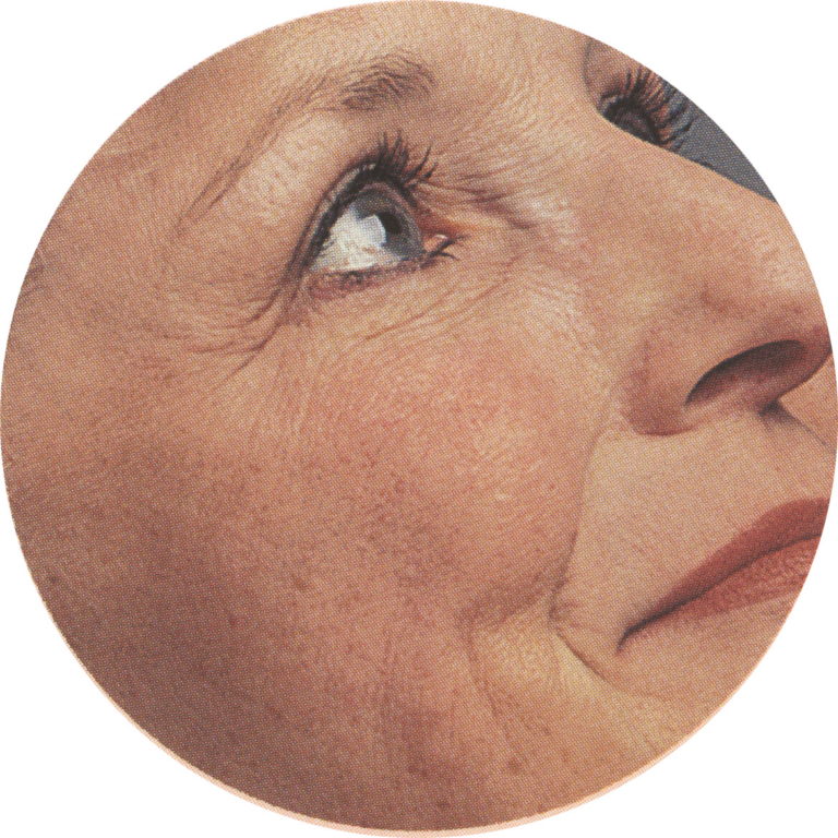 VISCODERM®Hydrobooster | IBSA Derma